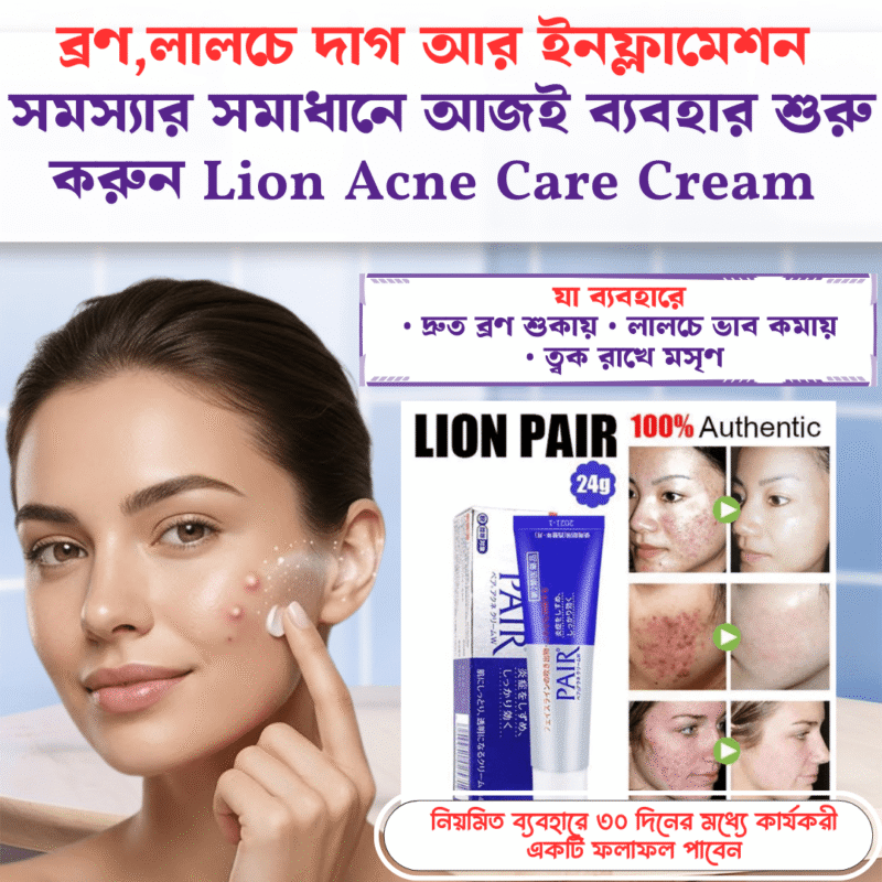 Lion Pair Medicated Acne Care Cream - gleamglows.com